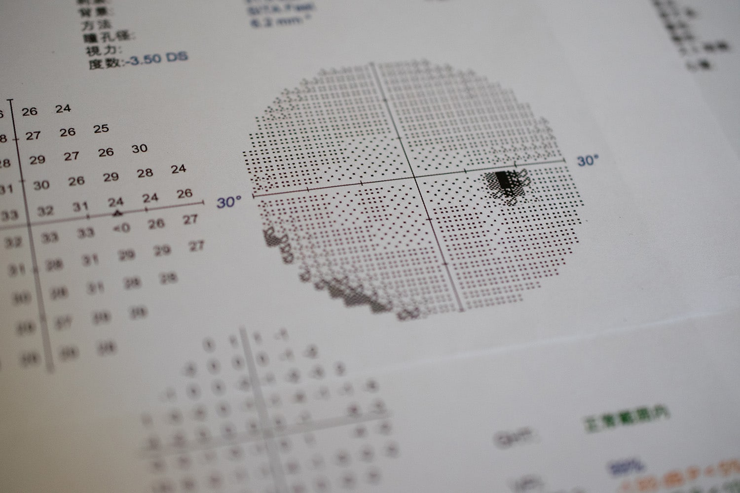 Understanding Visual Field Testing At Tower Clock Eye Center